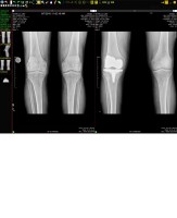 Orthopedic PACS Hardware and Software--Viztek Opal-Ortho