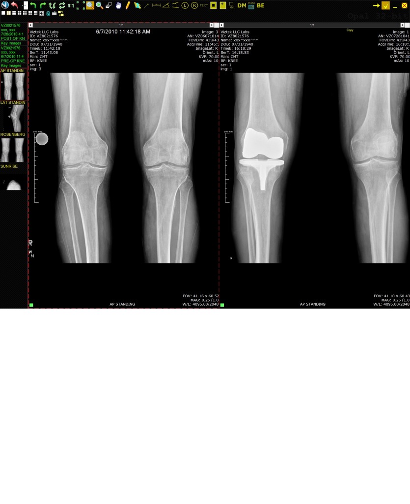 Orthopedic PACS Hardware and Software--Viztek Opal-Ortho